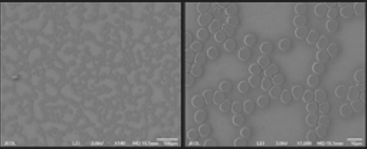 Electron Microscopy Of The Blood Of A 43 Year Old With 3 Pfizer ...