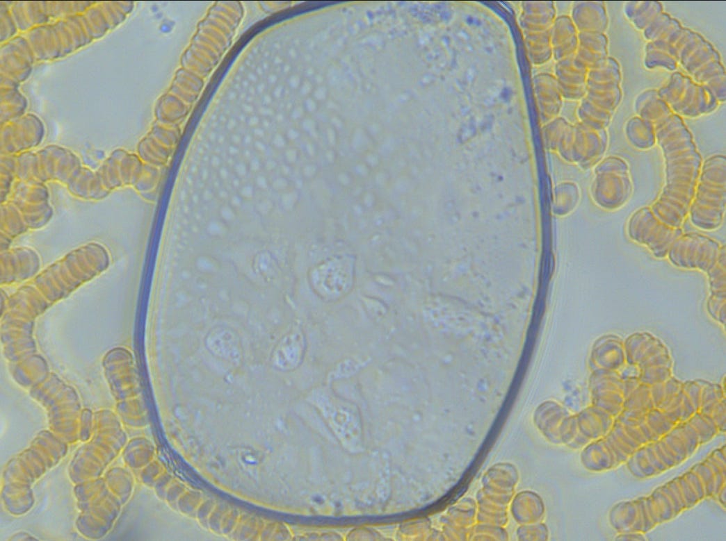 Self-assembly, Multi-lamellar vesicles and structures formed within the ...