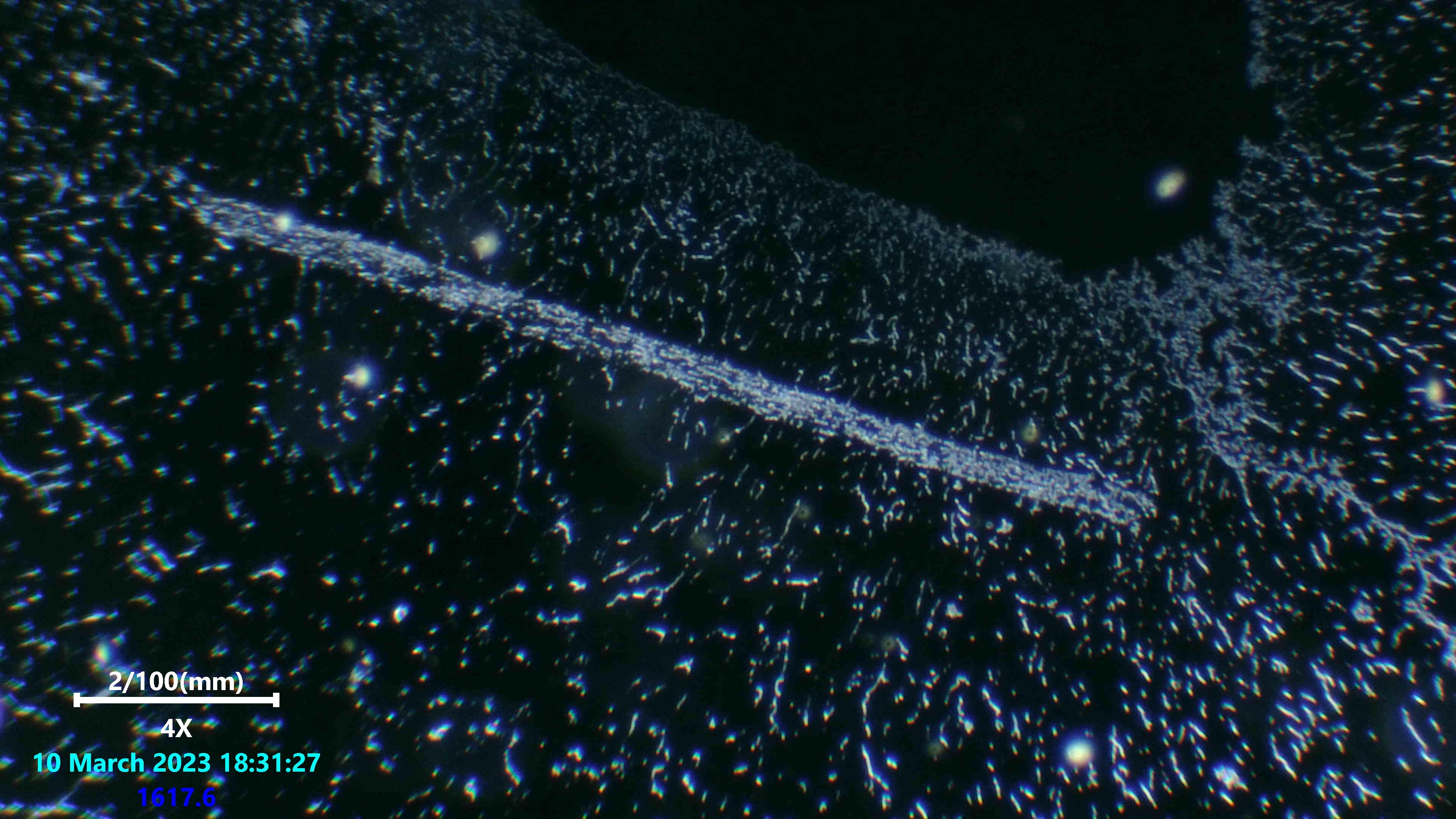 Fibers forming in blood, some of the varying ways I have seen it.