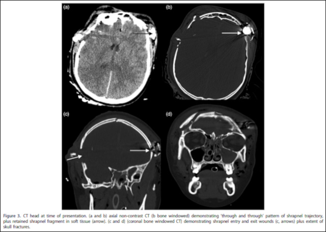 Brent and Neil go to Manchester - Part 8