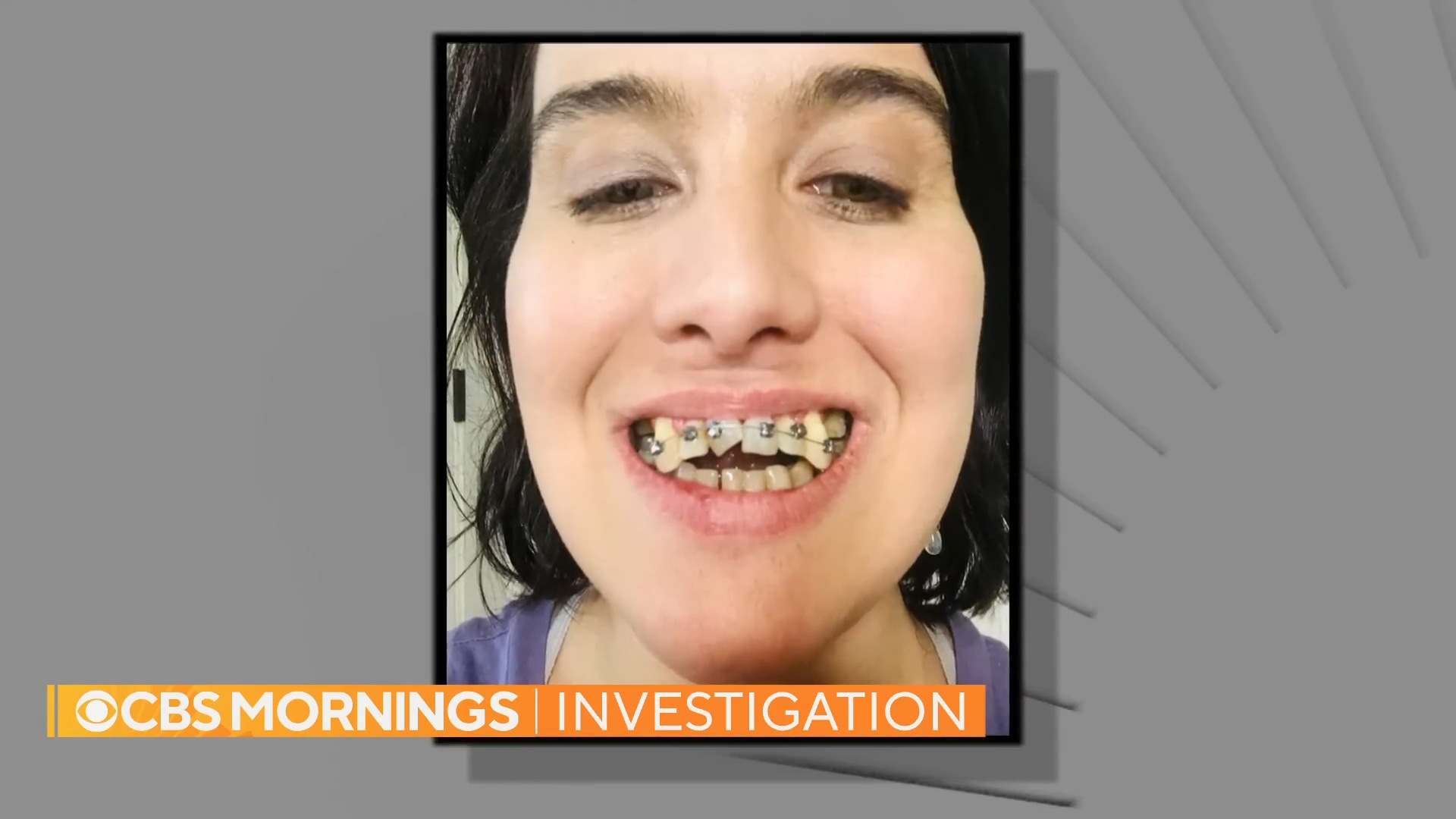 4.4 The AGGA Mass Psychosis - by Ronald Ead - JawHacks