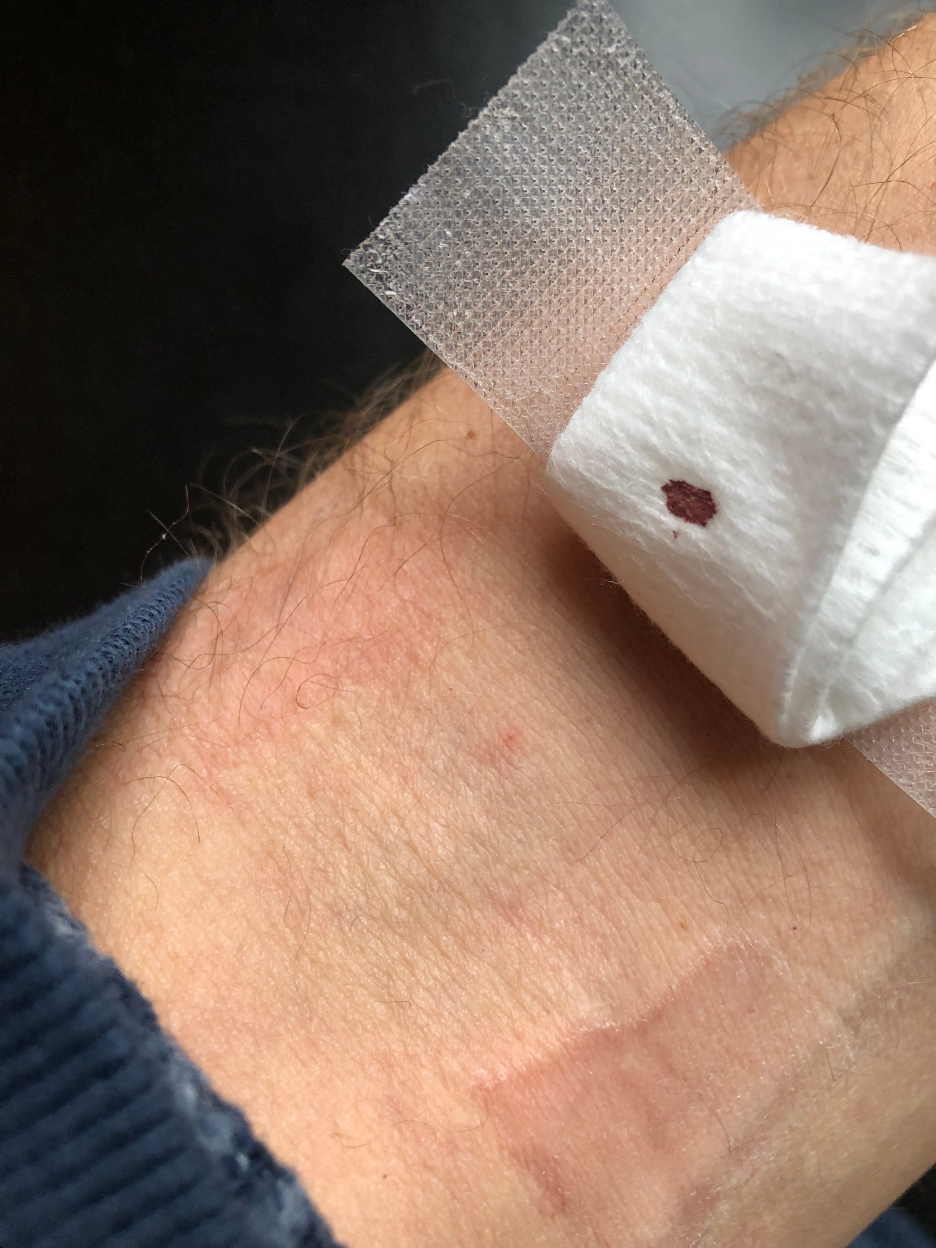 How to Avoid a Blood Draw Bloodbath