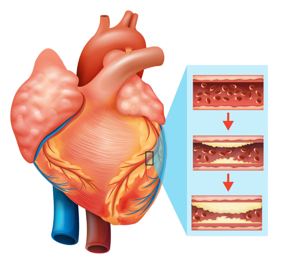 Heart talk - by Toni Moyes - Extend