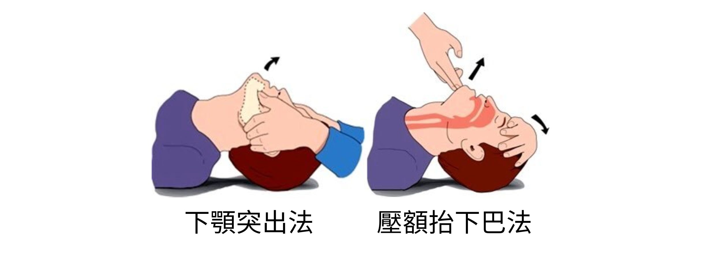 護理筆記 – 大量傷患檢傷分級 - 薇布WeiBuh💉護理站