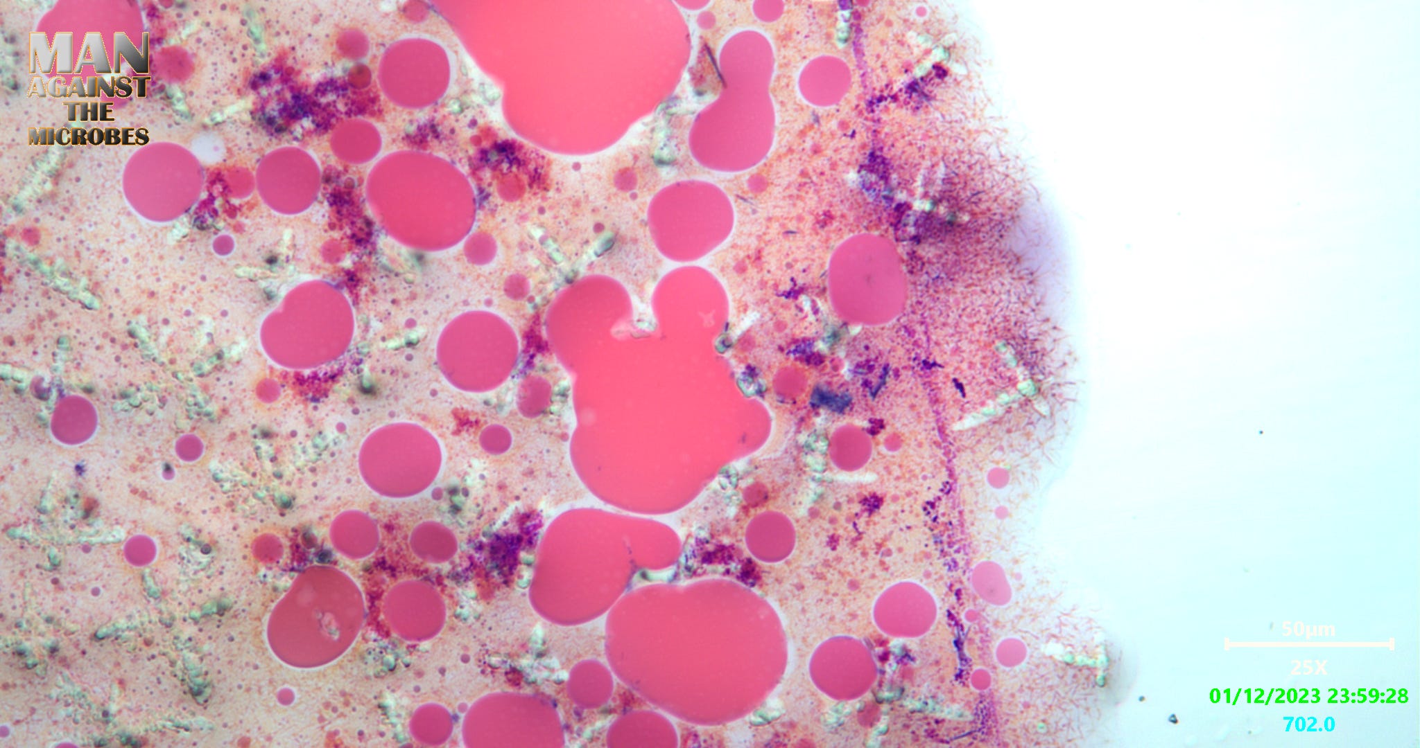 WoW! Staining of the swab solution show amazing chemical transitions ...