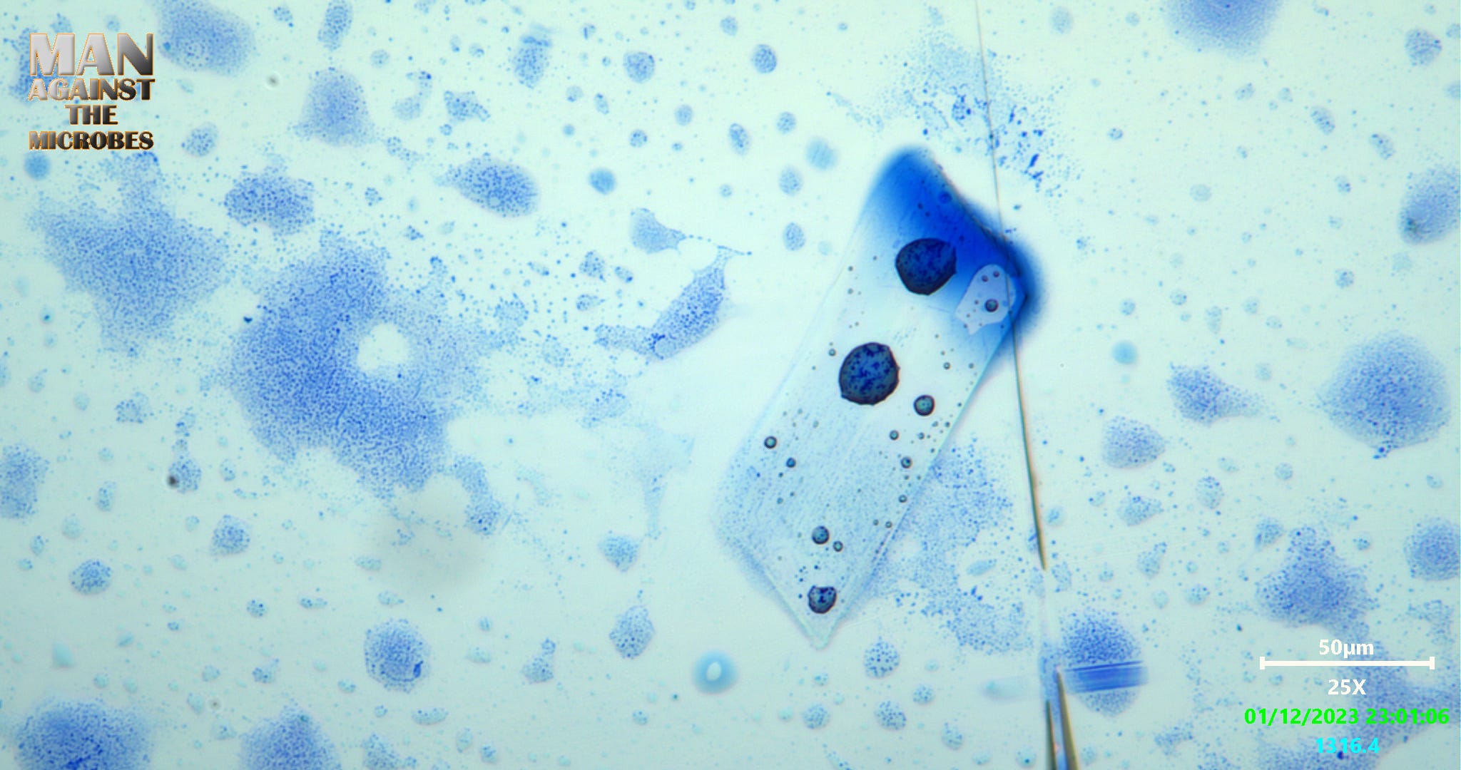 WoW! Staining of the swab solution show amazing chemical transitions ...