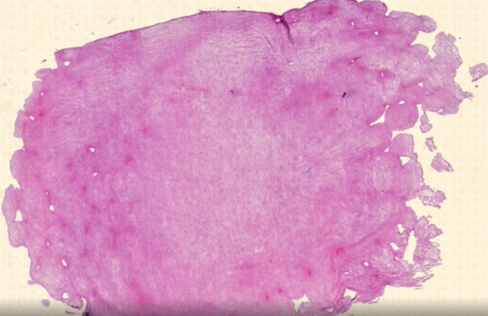 Pathologists Are Unaware Of The Pathogen Killing The Vaccinated - A Consequence Of Medical ...