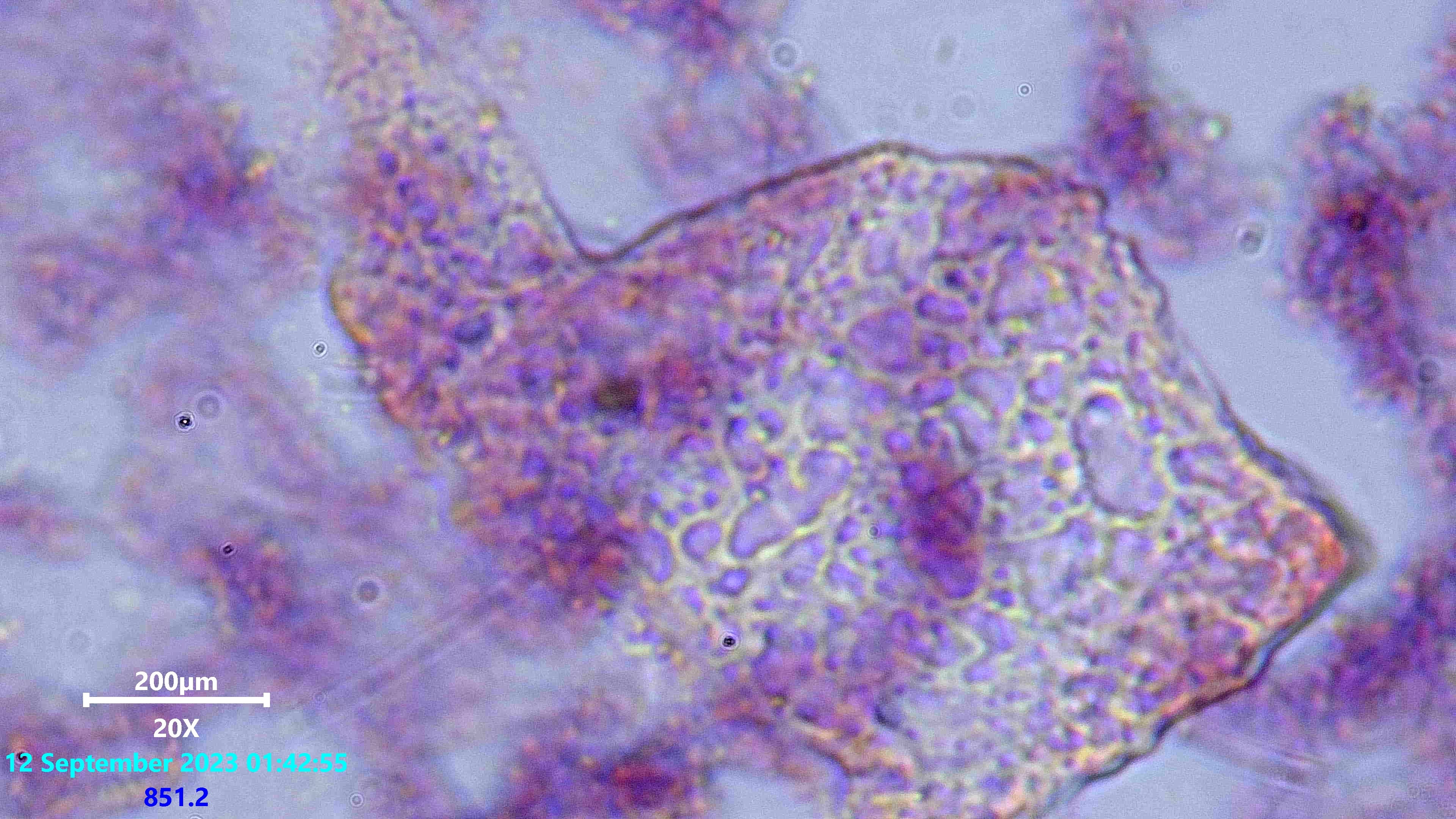 Gram staining of my blood reveals same abnormalities shown by ...
