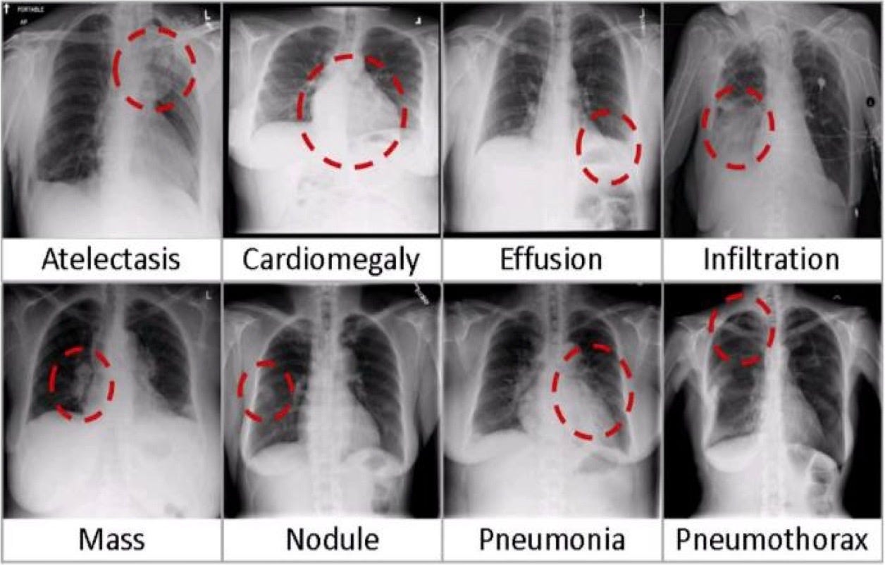 Screening for Silent Spike Toxicity - Dr. Syed Haider