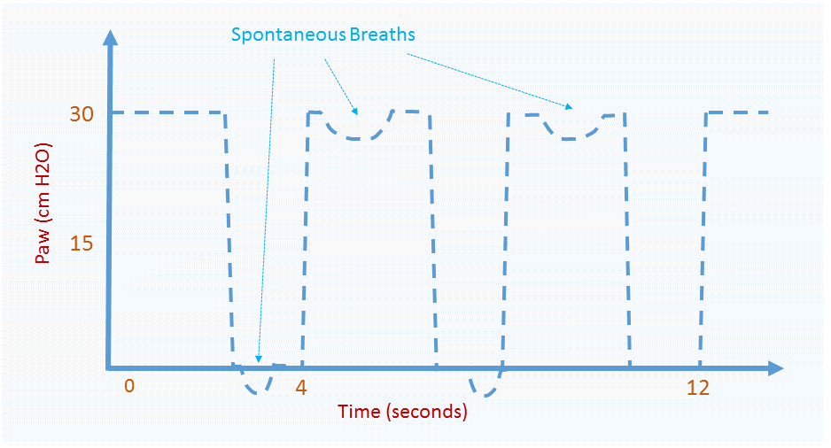 ICU Physiology in 1000 Words: Airway Pressure Release Ventilation – Part 1