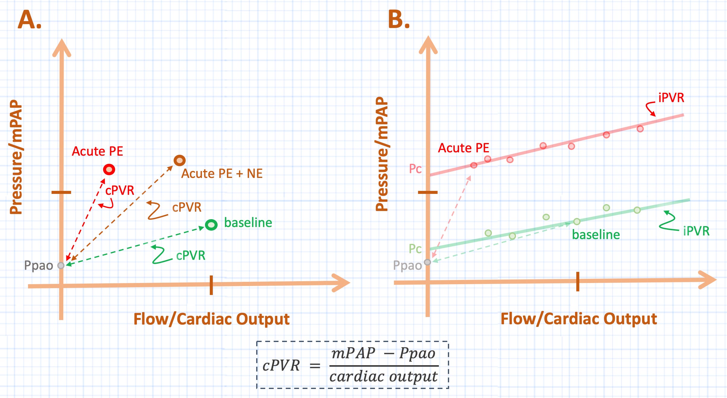 ICU Physiology in 1000 Words: Pulmonary Embolism & Pulmonary Vascular ...