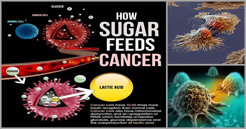 How Sugar Fuels Cancer Cells in the Body - by GL Hendricks