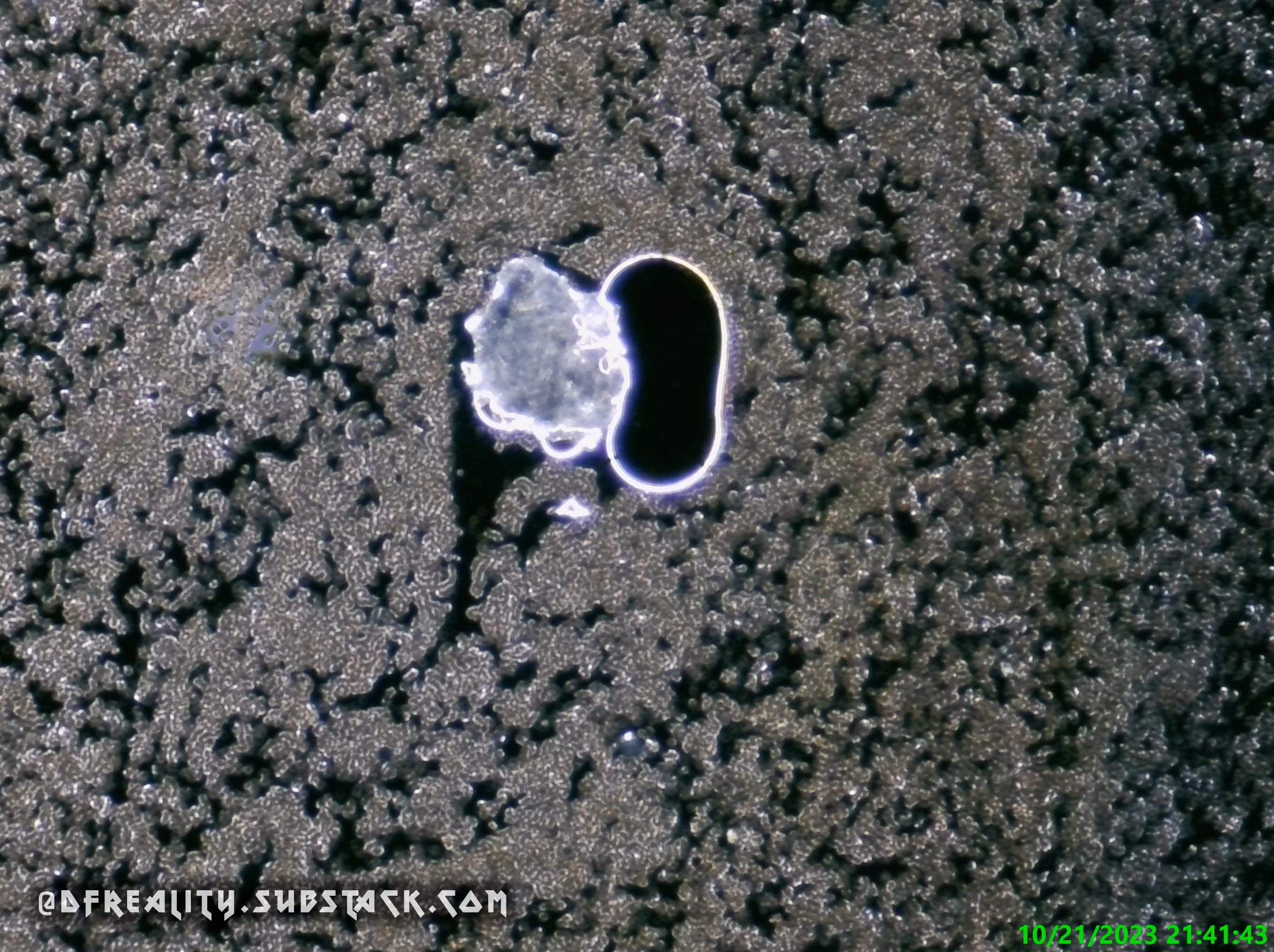 Live Blood Analysis: 18 F, Unjabbed - by Scipio Eruditus