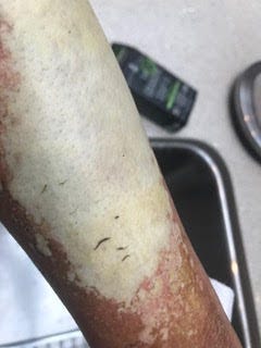 Peroxide - Warning - by matt. j.a.o.b - matt’s microscopy