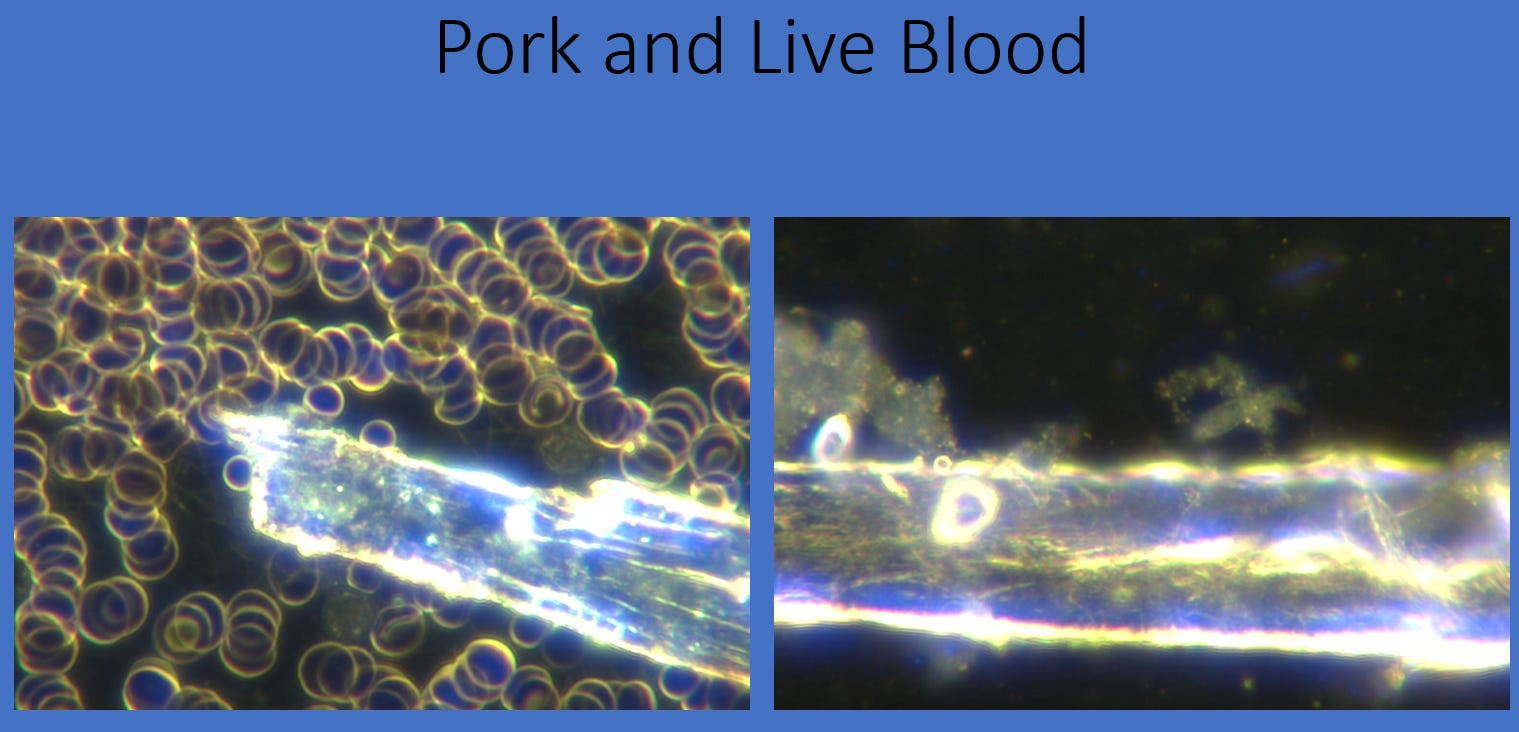 Analysis of Meat Live Blood From Australia By Dr. David Nixon ...