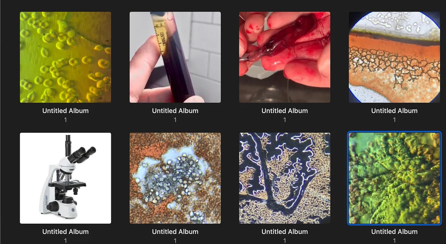 ULTIMATE GUIDE to the ANTI-NANO TRIANGLE and SPIKE DEVICES