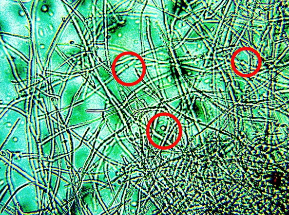 Blood Cultures of Unvaccinated Blood Shows Extensive (CDB) Filament ...