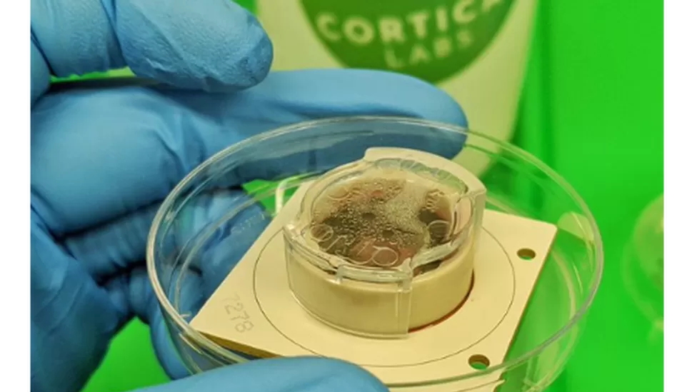 Organoid Intelligence: Lab-Grown Human Brains as AI Bio-Hardware