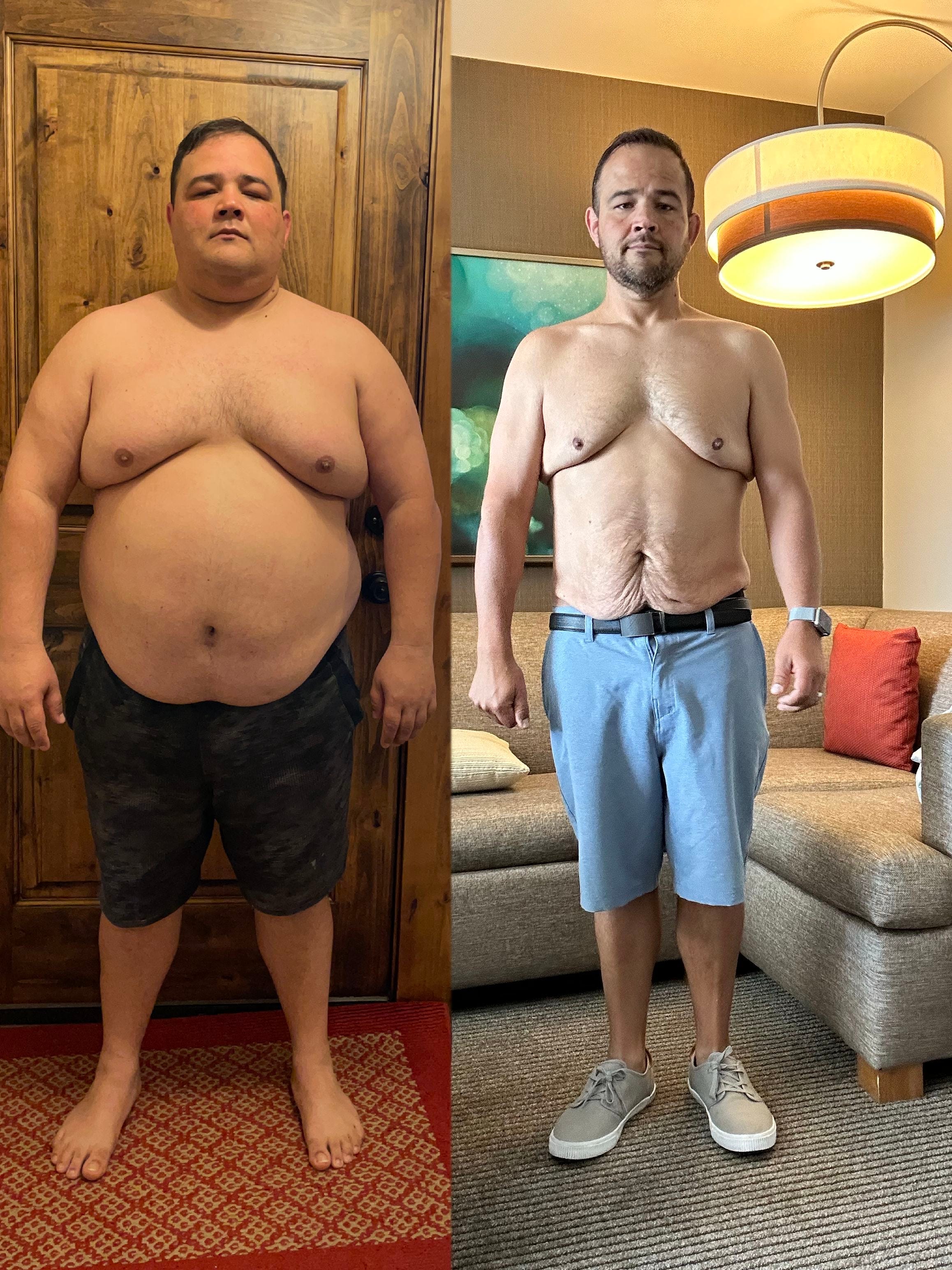 Are Ozempic and Mounjaro the Magic Weight Loss Bullet?