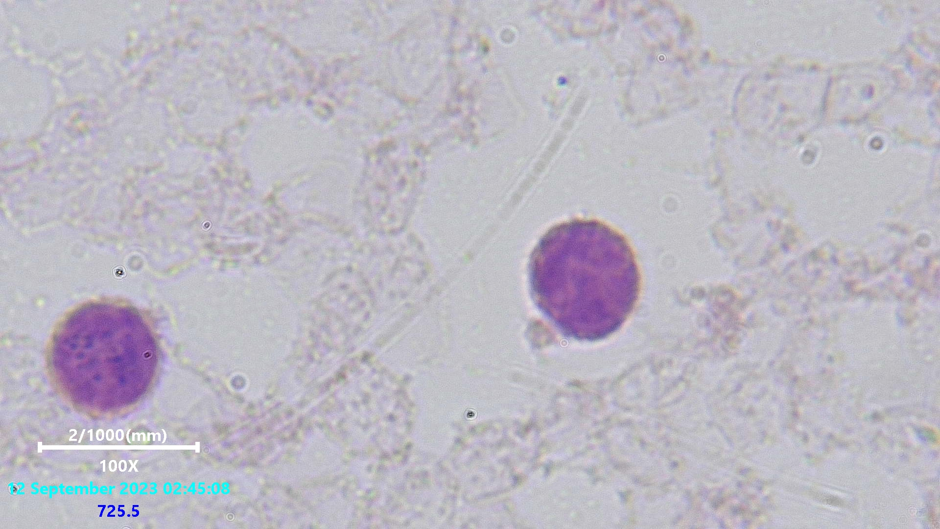 Gram staining of my blood reveals same abnormalities shown by ...