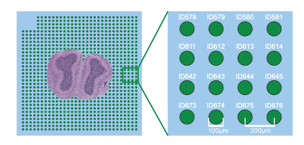 Every cell talks: How Spatial transcriptomic tools are trying to decode ...