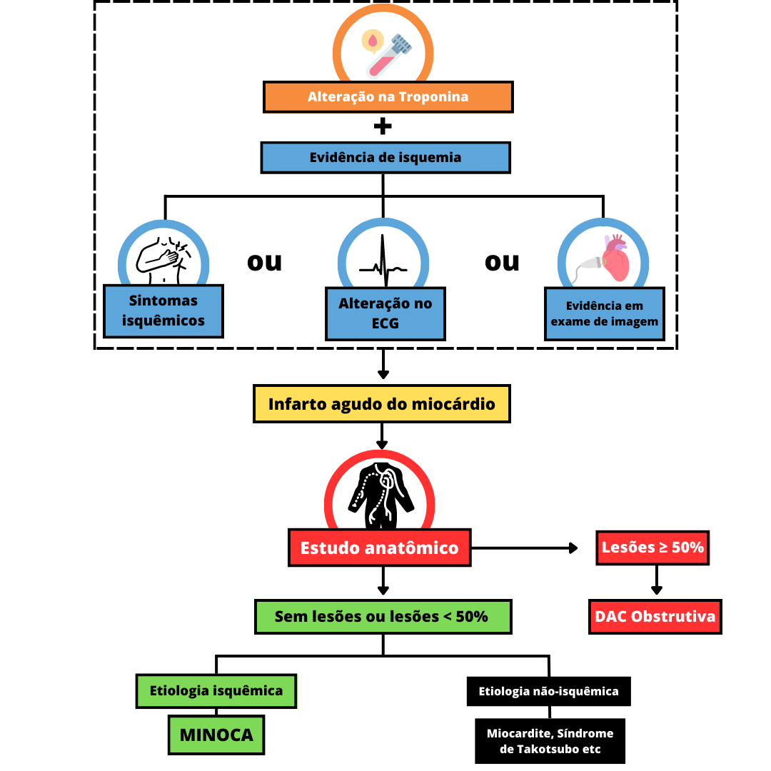 MINOCA, o que fazer?