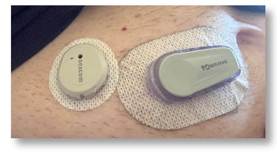Continuous Glucose Monitors: Does Better Accuracy Mean Better Glycemic ...