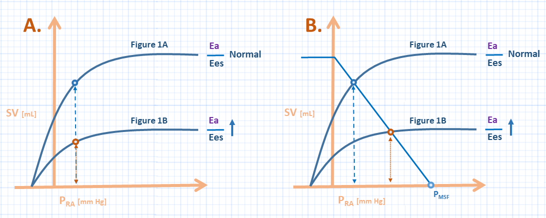 ICU Physiology in 1000 Words: Venous Doppler & Veno-Cardiac Coupling ...