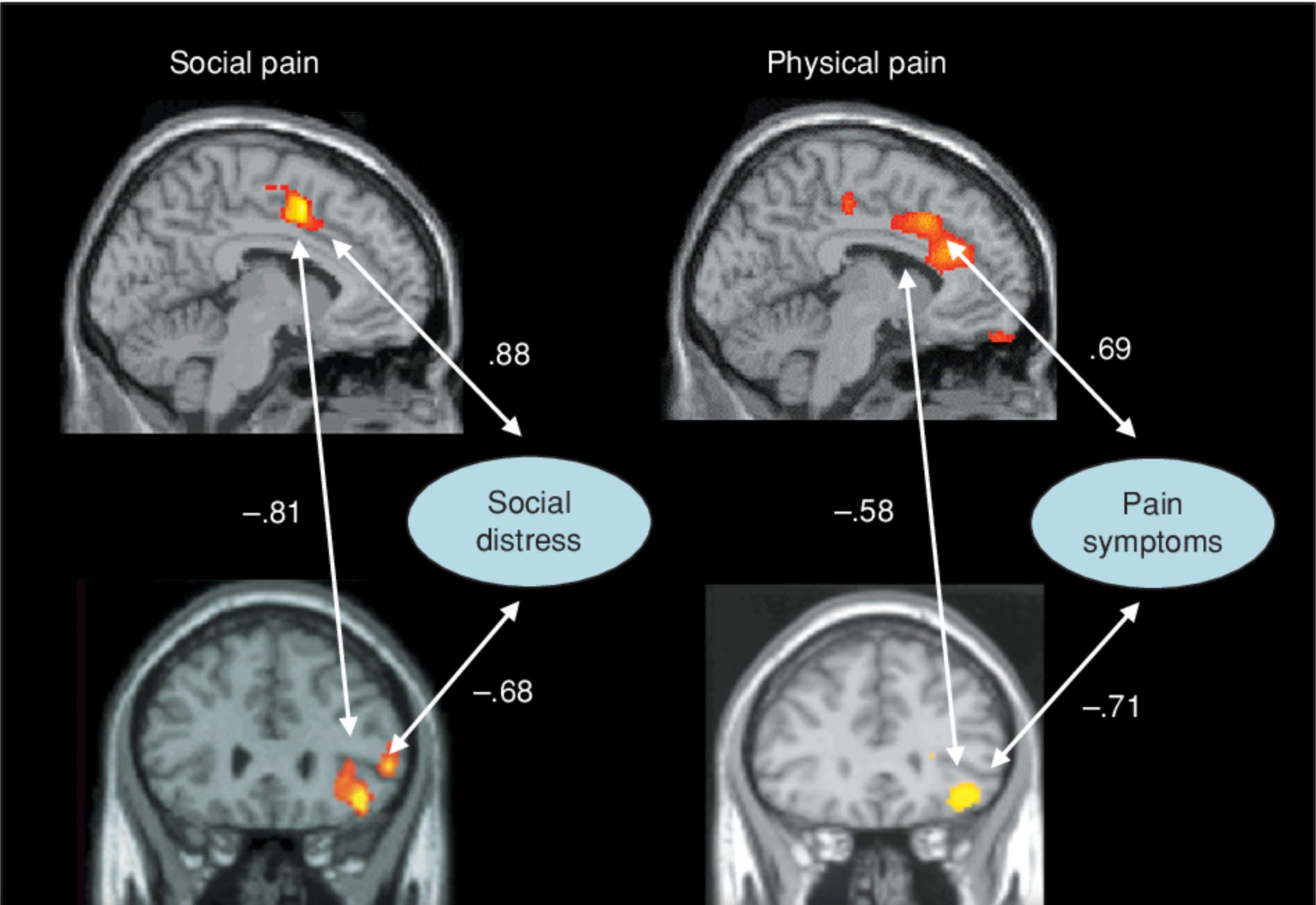 The Science of Why Rejection Stings and How You Can Overcome It 😰 ...