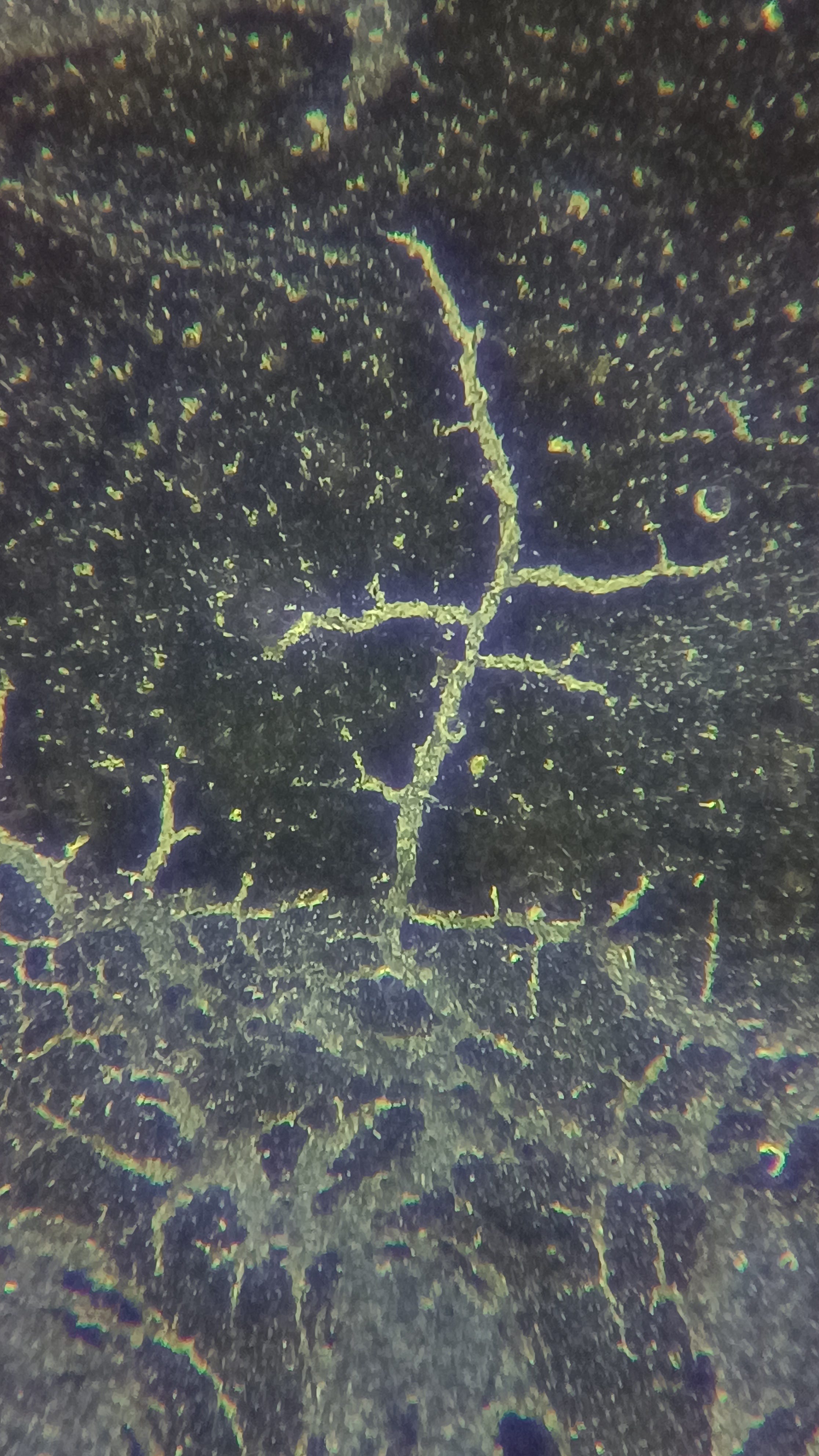 Dental Anesthetics. - by matt. j.a.o.b - matt’s microscopy