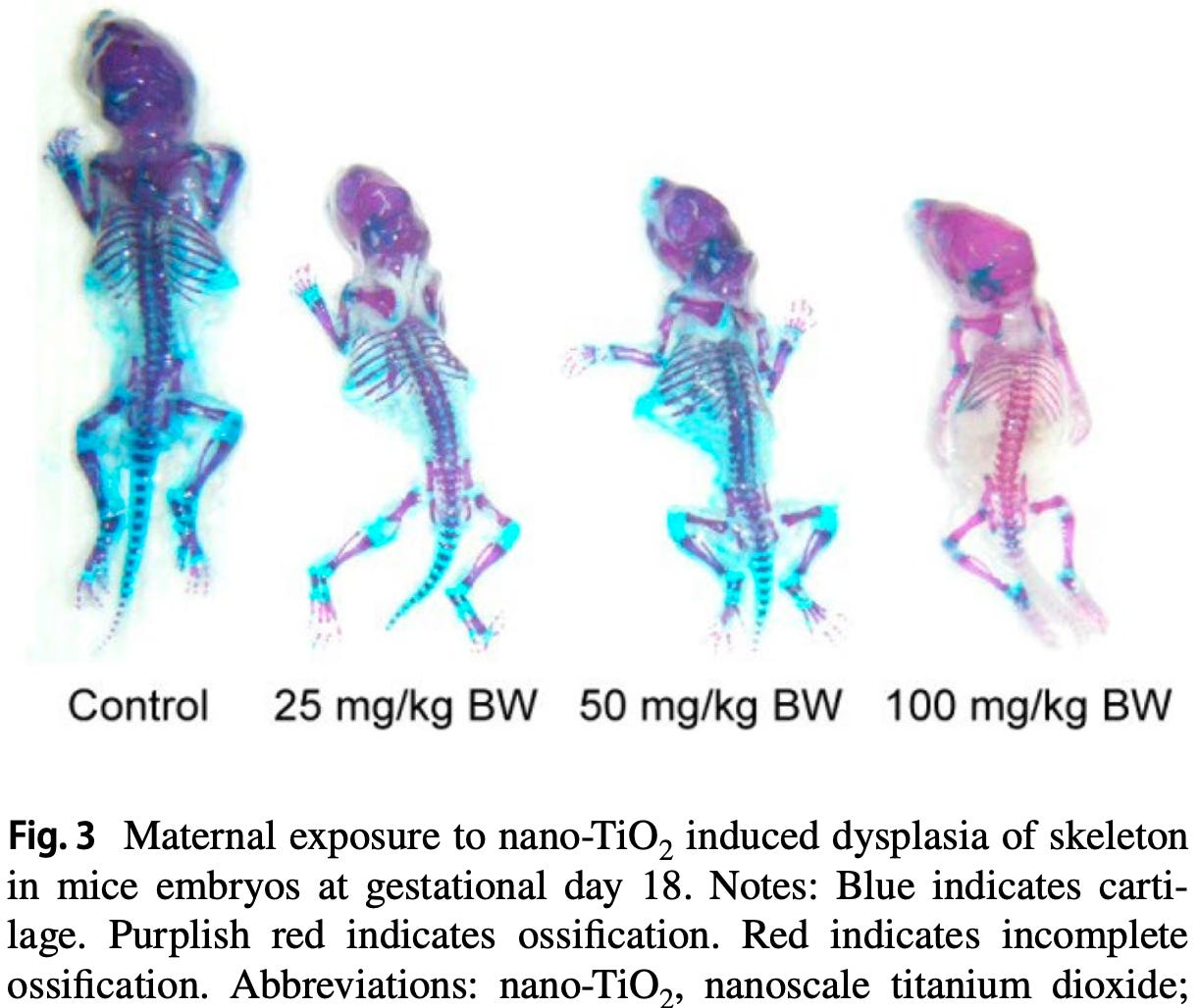 Titanium Dioxide Nanoparticles Don't Belong in our Food Supply