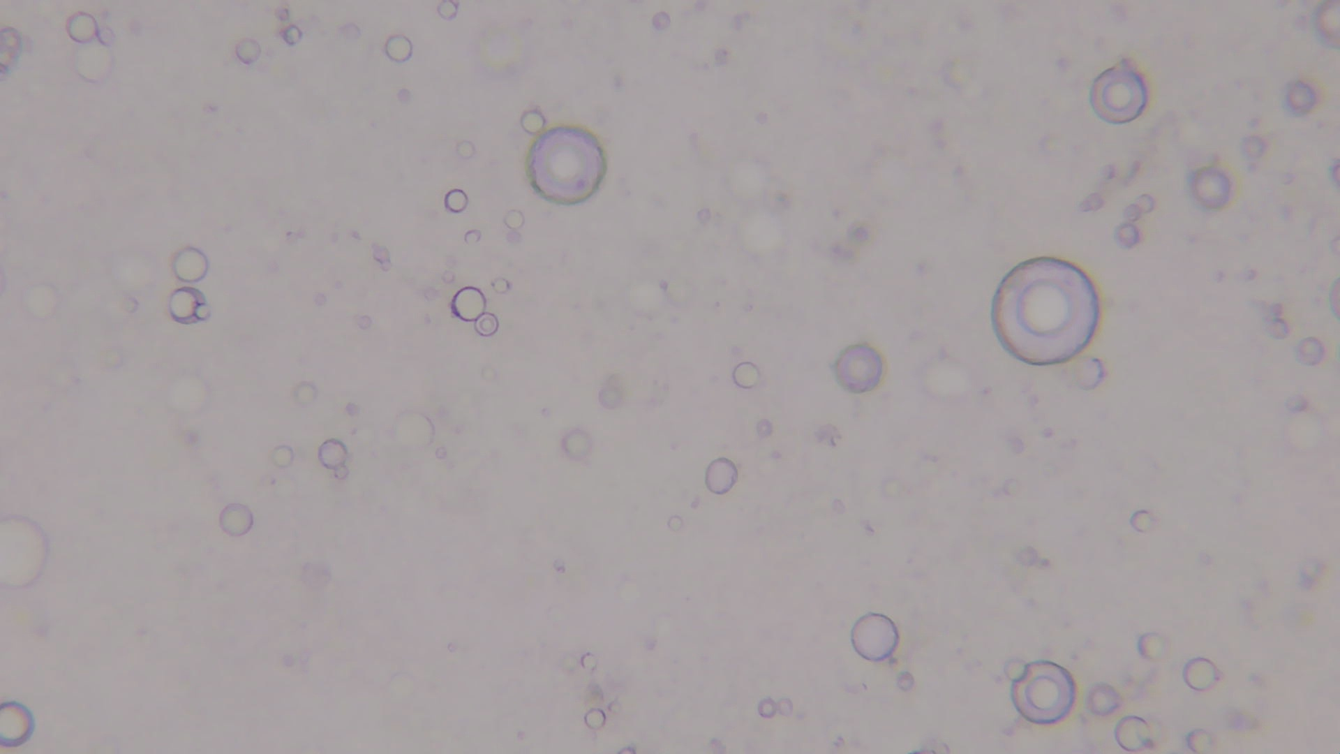 Microscopy of Eggs from Our Chickens