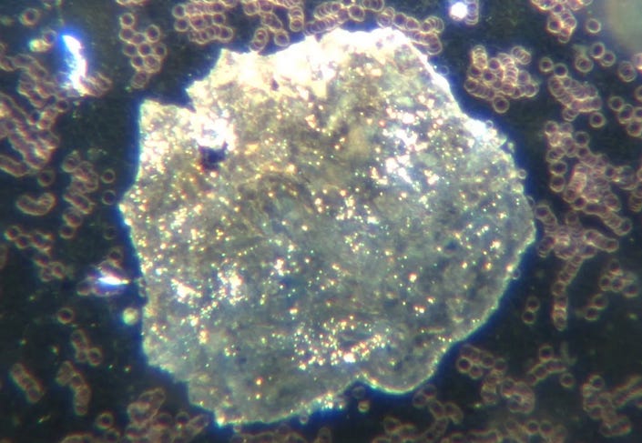 Darkfield Live Blood Microscopy Of A Discoid Mesogen Self Assembly ...