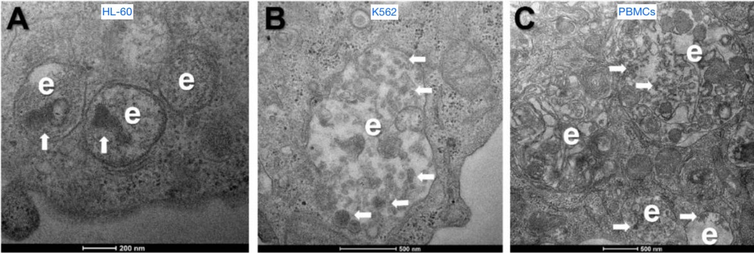 Myocarditis And Bolus Theory - by Brian Mowrey - Unglossed