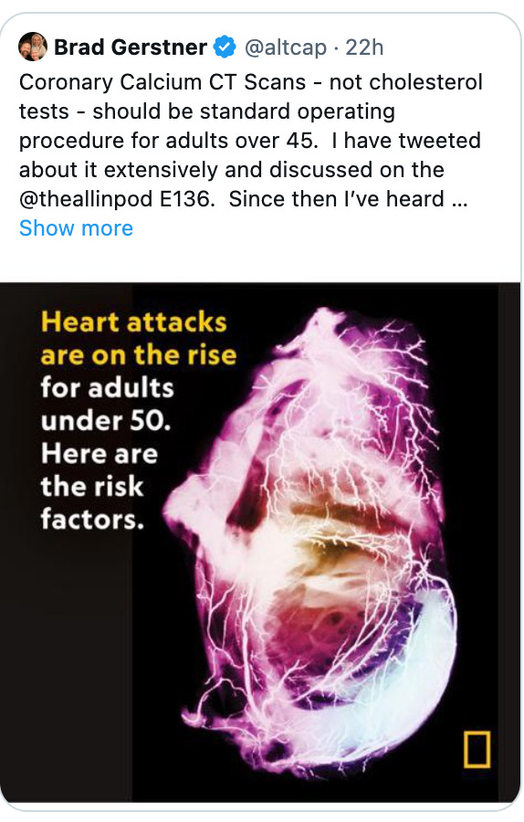 Coronary Artery Calcium Scans Are Not the Answer