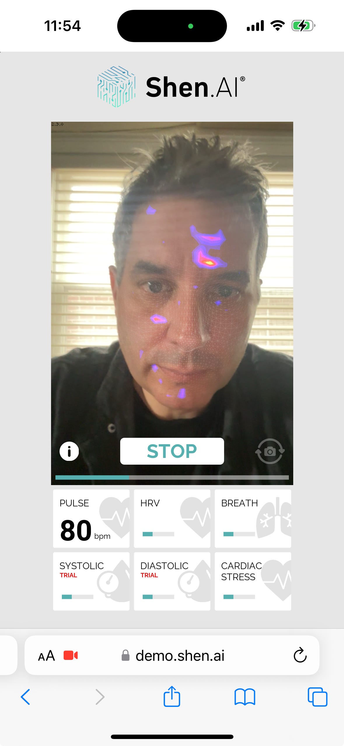 Startup Profile: Shen.ai senses your vital signs with your phone camera