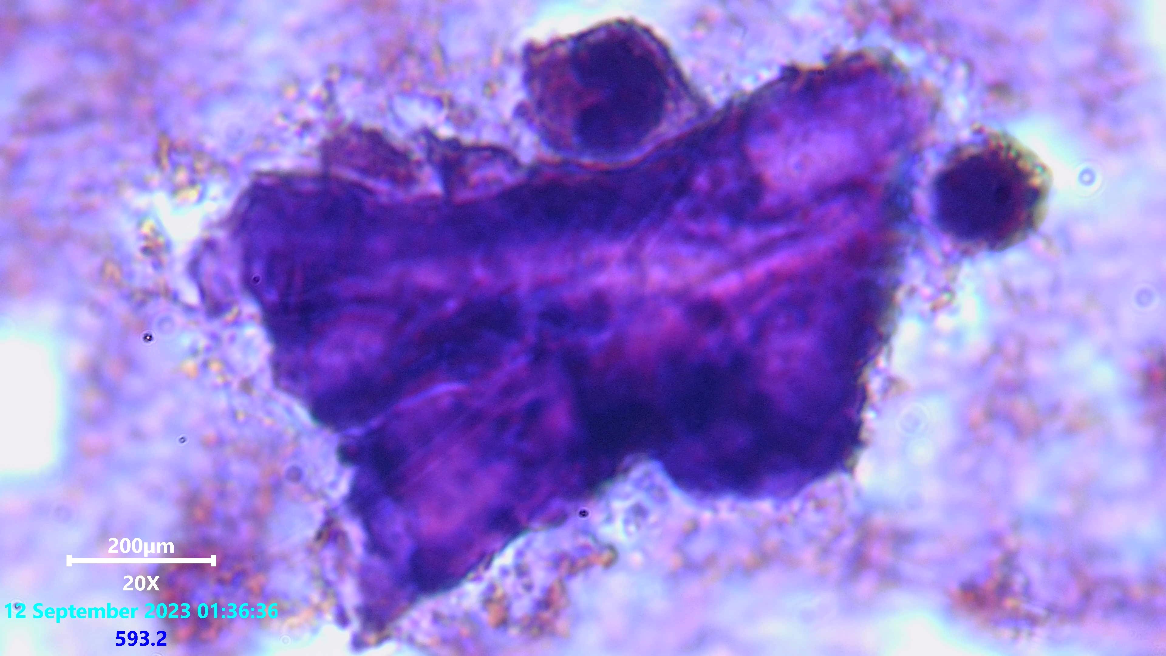 Gram staining of my blood reveals same abnormalities shown by ...