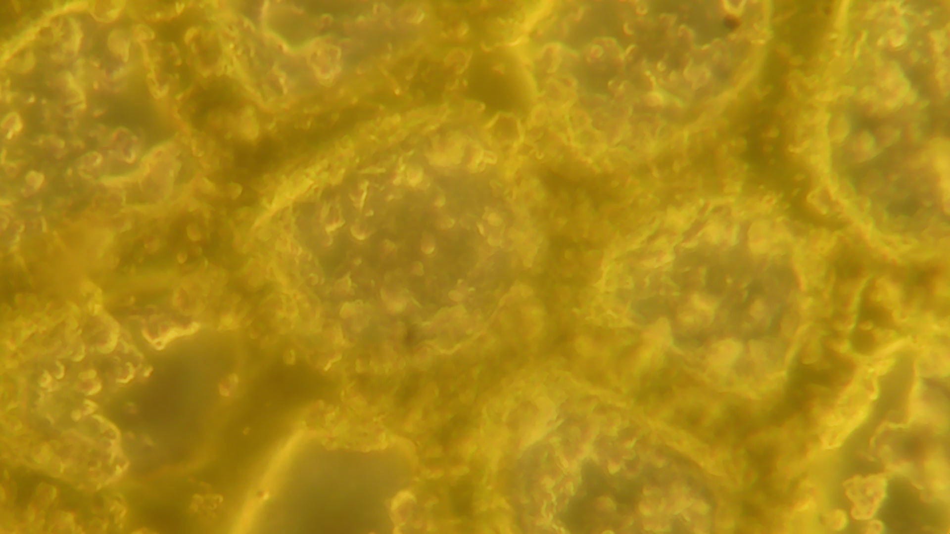 Homegrown Tomato Skin Stains Under The Microscope