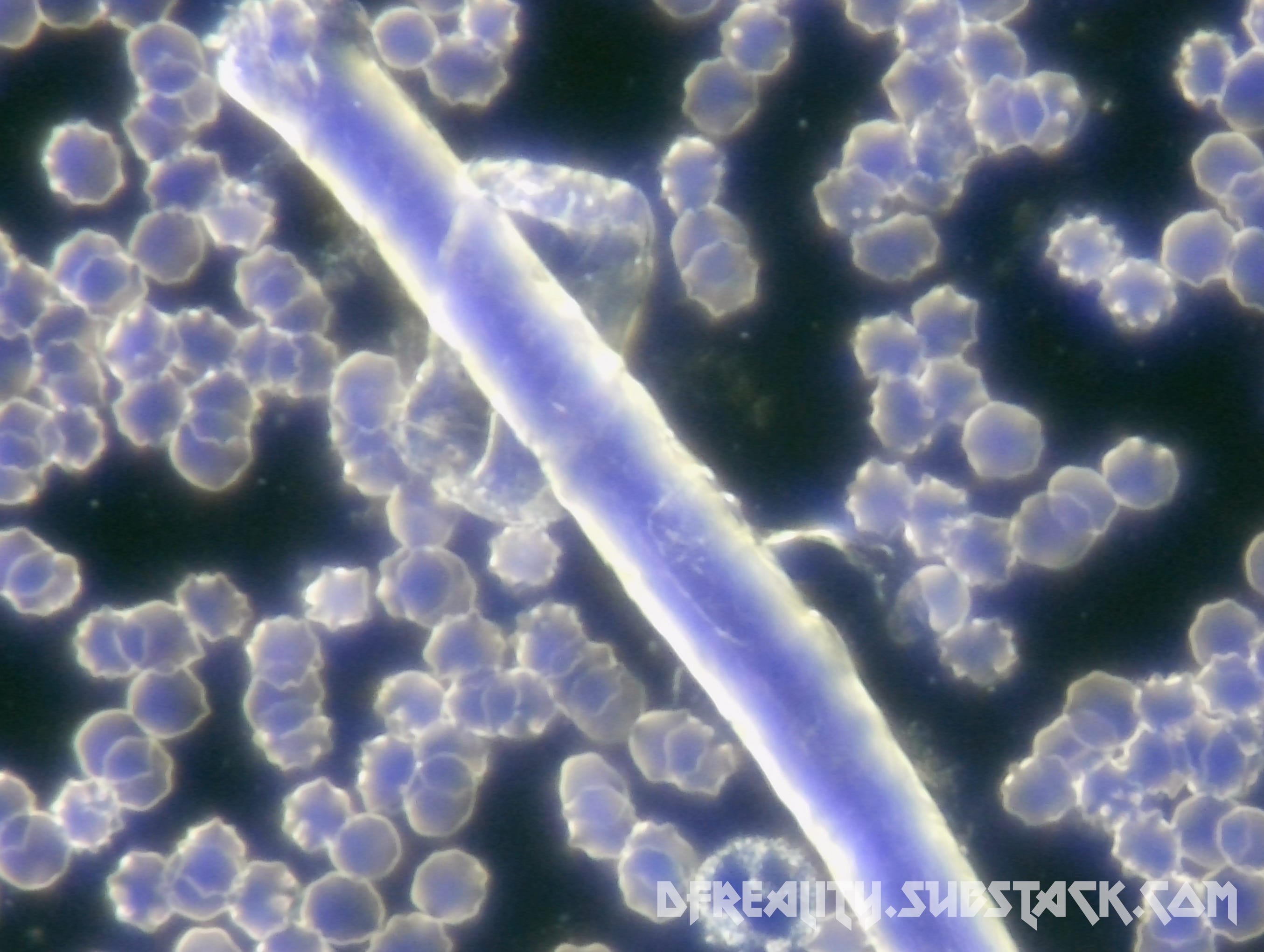 The Mass Poisoning of America: A Case Study