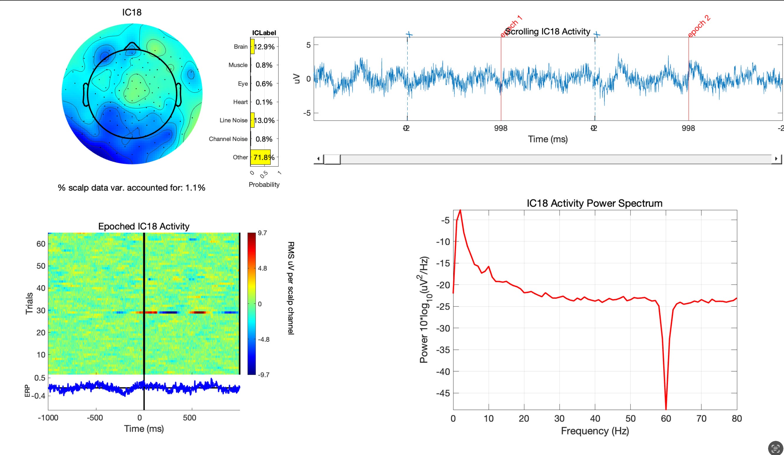 Automating Post-ICA EEG Component Rejection in MATLAB Automating Post-ICA EEG Component Rejection in MATLAB