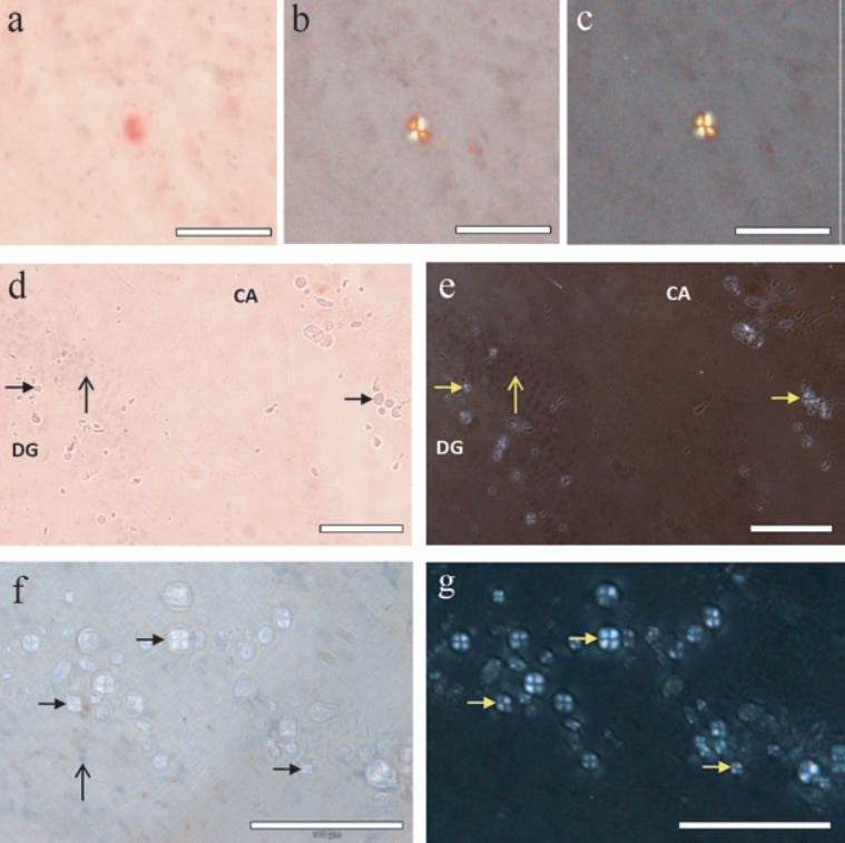 Starry, Starry Spherulite - by Dr Christopher Exley