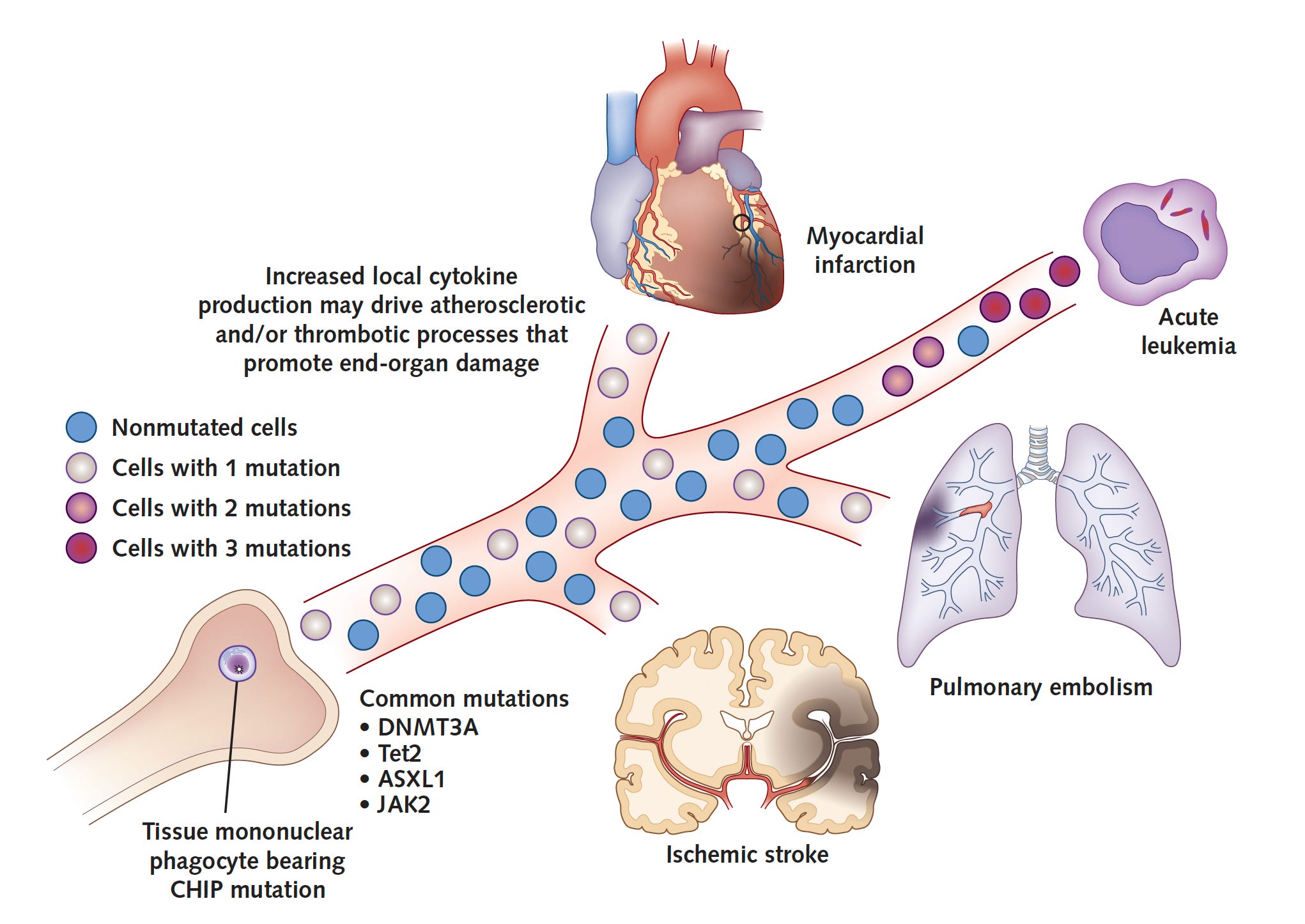 The under-appreciation of CHIP - by Eric Topol