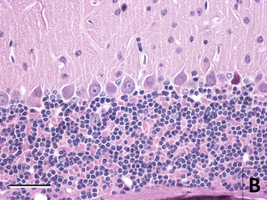 What should we be measuring in brain preservation?
