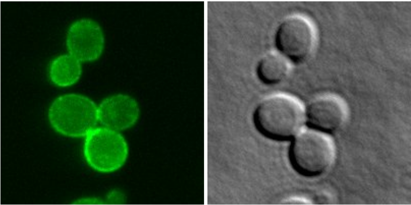 GNAO1 yeast avatars for drug multipurposing