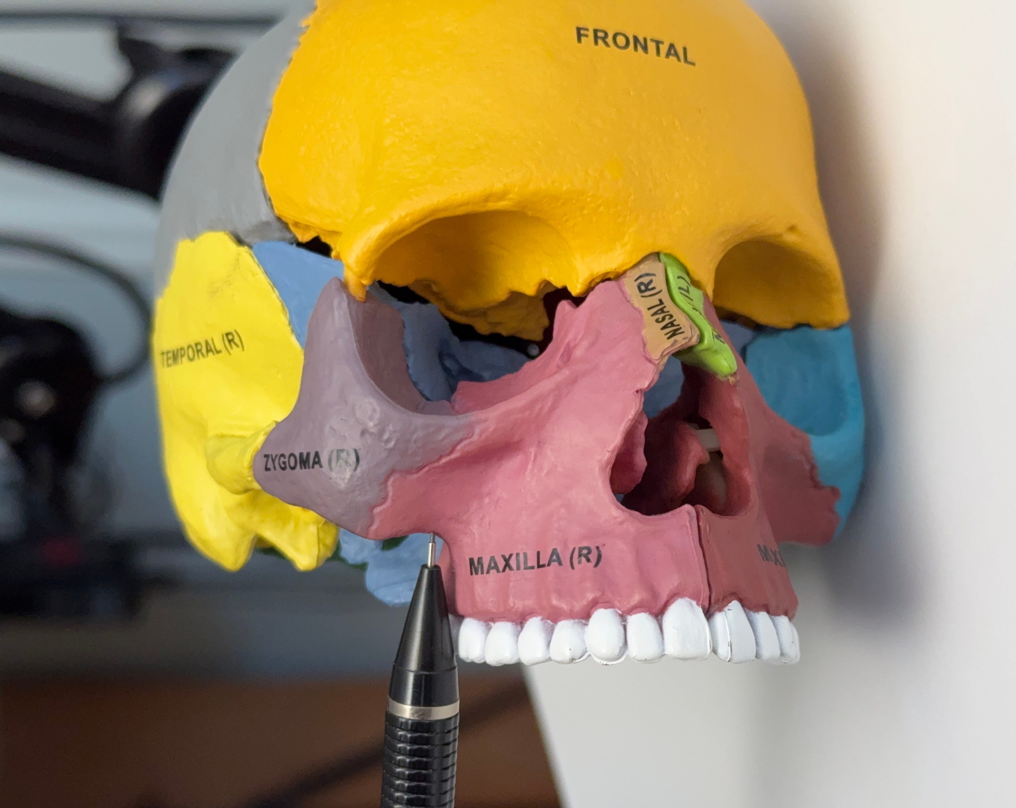 5.4 MARPE Surgical Assists - From Least to Most Invasive