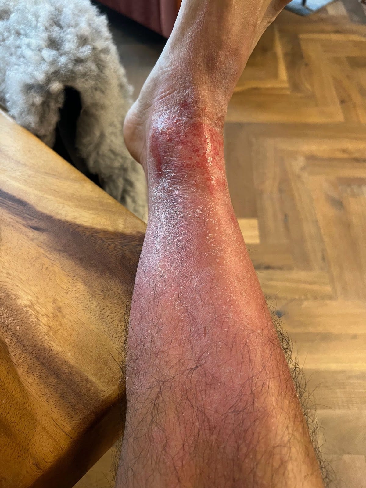 The Bathtub Formula for Optimal Health - by Eric Ho