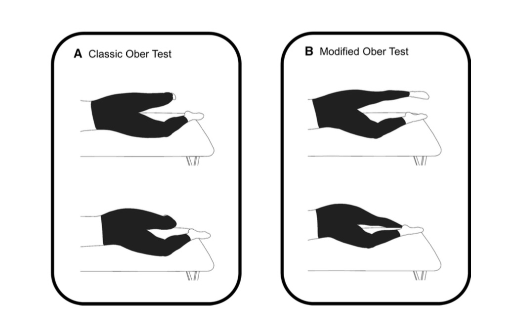 Entendiendo la banda iliotibial - Pura Fisioterapia