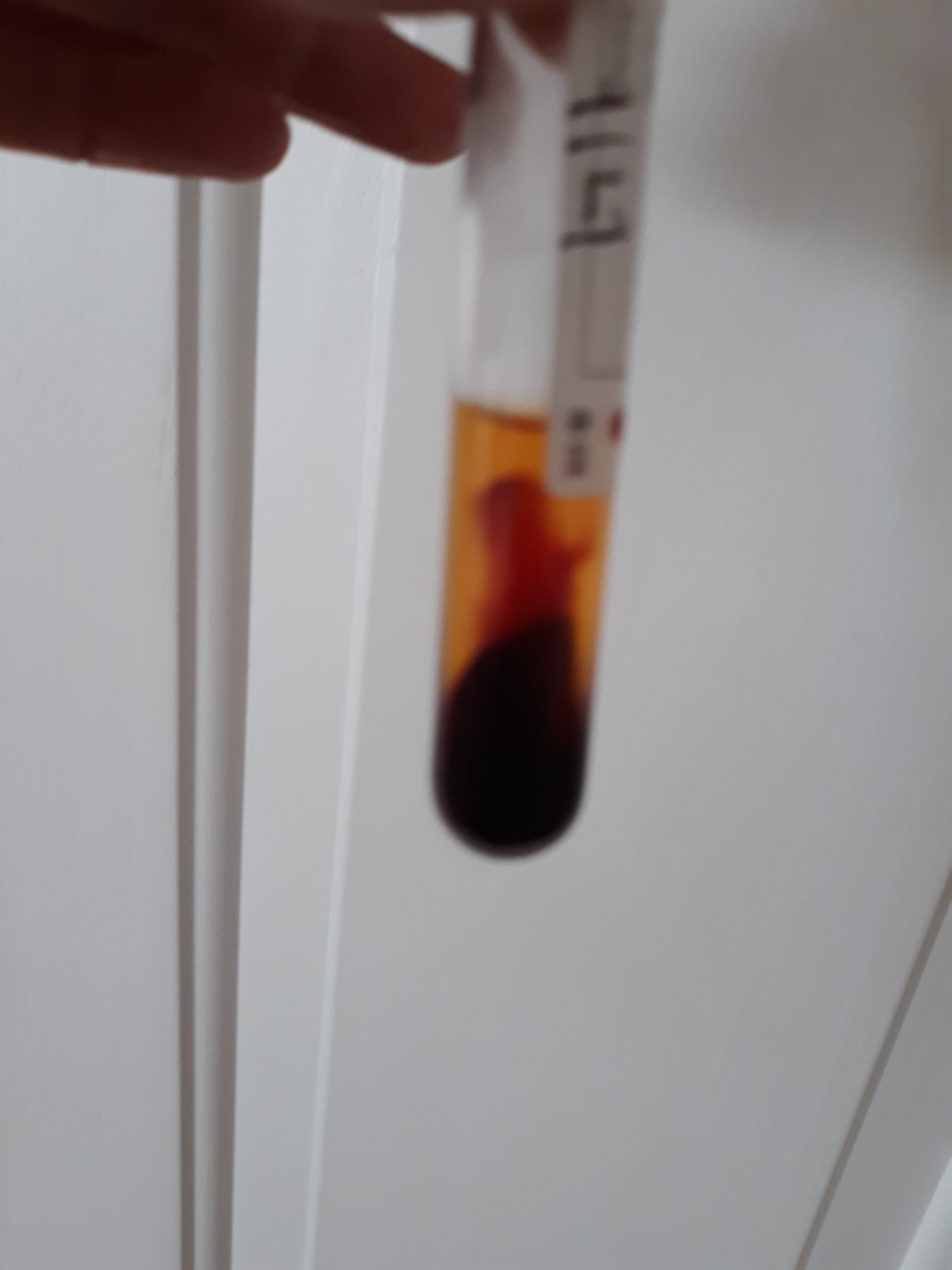 Gel/plastic Returns After Holding this Treatment