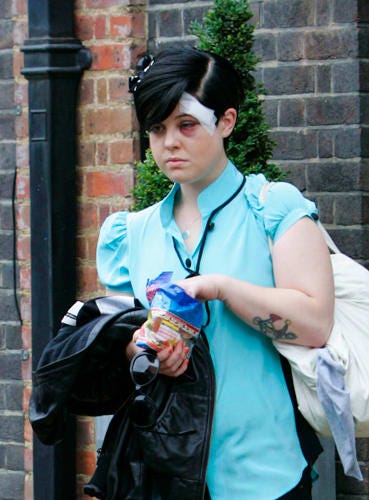 ADRENOCHROME / C9H9NO3: The “Black Eye” Club Finally Exposed