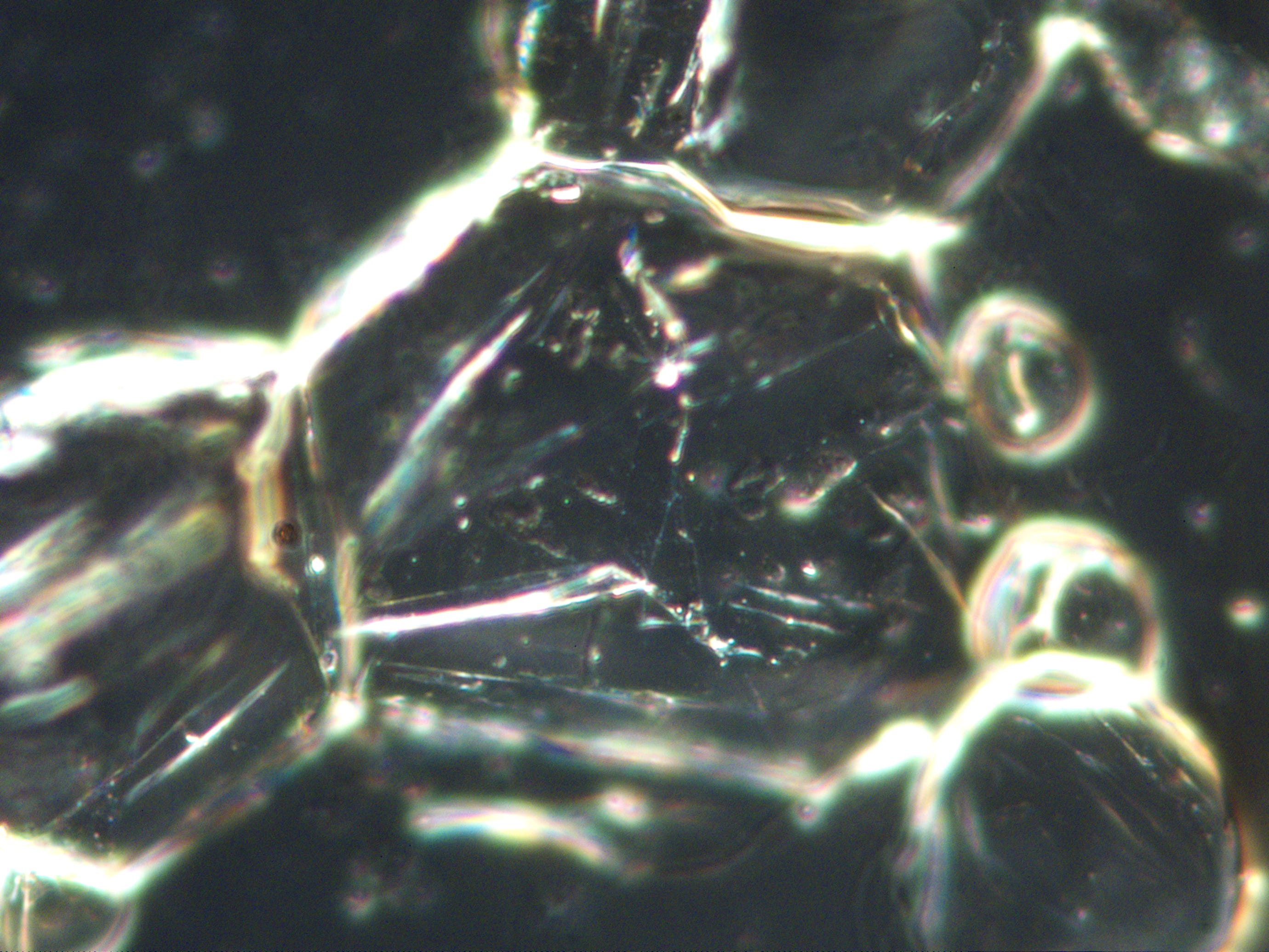 Hydrogen Peroxide added to blood reveals highly concentrated amounts of ...